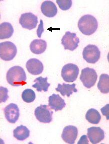 Clinical pathologist's interpretation